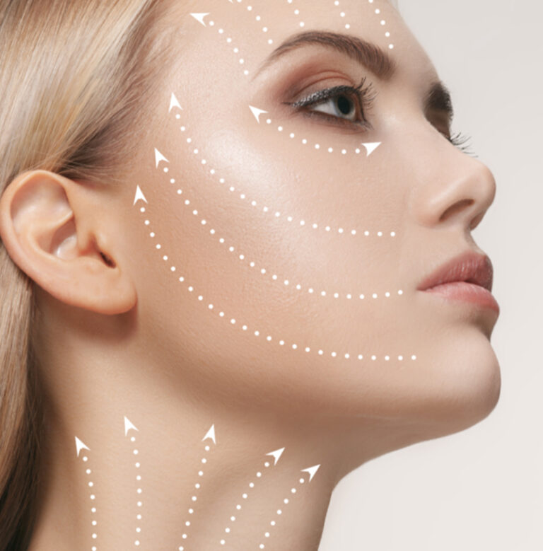 Plasma Lift - Macebydrmace.com